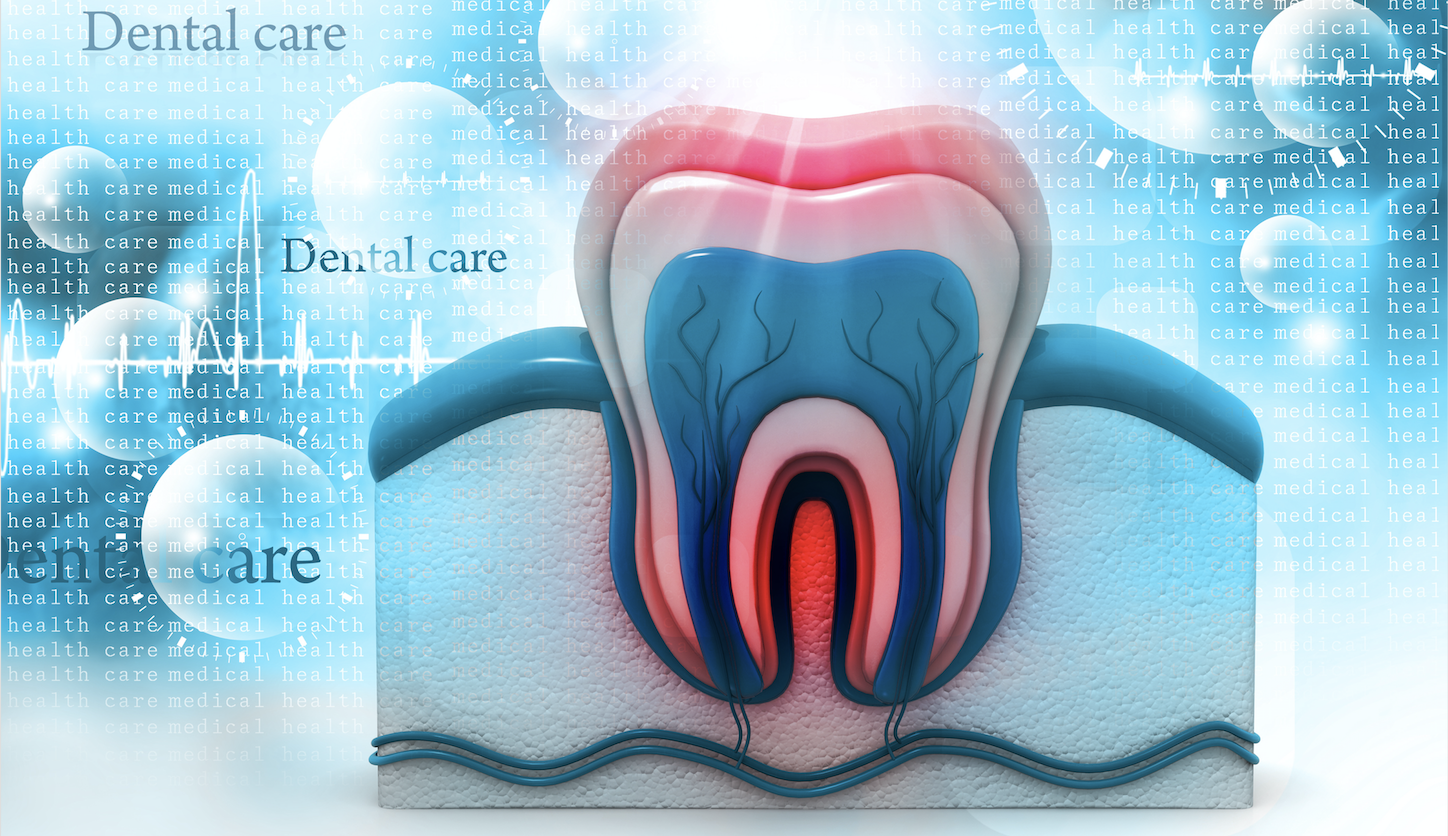 Importance of Resorbable Membranes in Implant and Periodontal Surgery